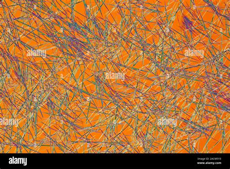 Ciprofloxacin Crystals Fluorescence Light Micrograph Of Crystals Of The Broad Spectrum