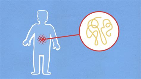 The Mysterious Appendix Unraveling The Riddle Of The Vermiform