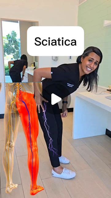 Printable Exercises For Sciatica How To Fix Sciatica Sciatic
