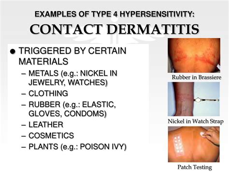 Ppt Immune Disorders Overview General Concepts Powerpoint Presentation Id 860175