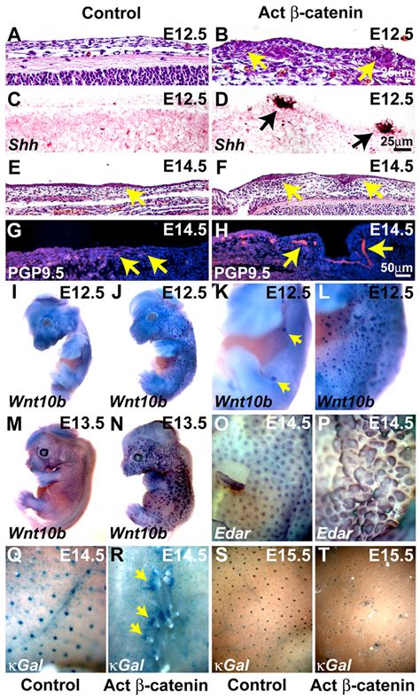 Premature And Expanded Placode Development In β Catenin Mutant Embryos