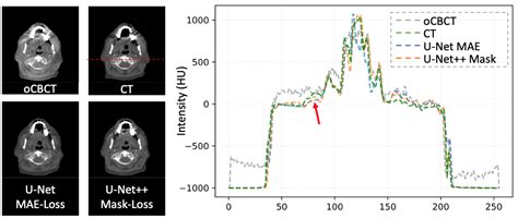 Nimus Paper On Head And Neck Synthetic Ct Generated From Ultra Low