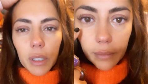 Sofia Ribeiro Apanha Uma Alergia E Confessa Vai Me Cair O Nariz