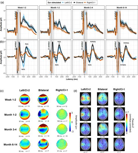evoked potentials with increased bilateral ci use a global field
