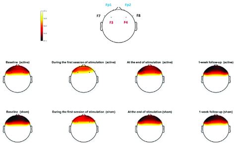 Topoplots Of Alpha Power In The Individual Electrode For Calculating
