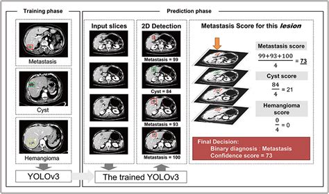 Diagnostic Performance Of Deep Learning Based Lesion Detection Algorithm In Ct For Detecting