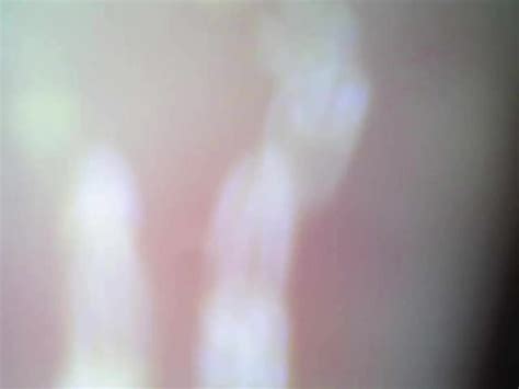 Mouth Tour With Endoscope 2 Mouth Tour With Endoscope 2
