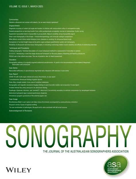 Excited To Share My First Published Journal Article A New