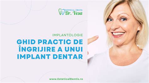 Ghid Practic De Ingrijire A Unui Implant Dentar