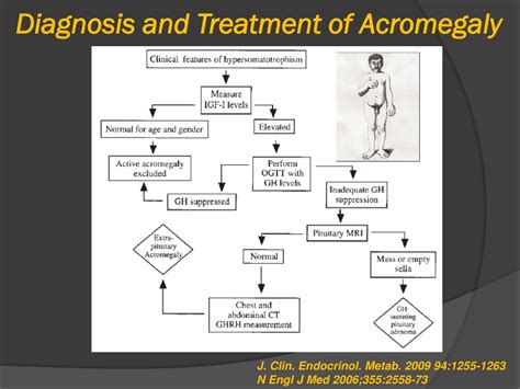 Ppt Diagnostic Approach Of Acromegaly Powerpoint Presentation Free