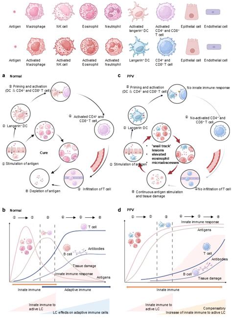 Pyodermatitis Pyostomatitis Vegetans The Role Of Langerin Deficiency