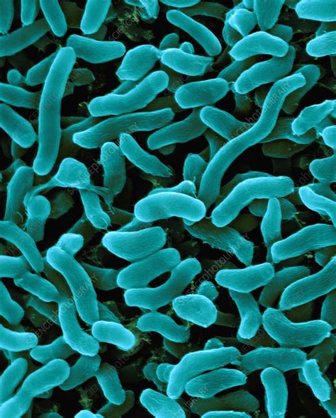 Halophilic Bacterium Arcobacter Halophilus Sem Stock Image C032 1807 Science Photo Library