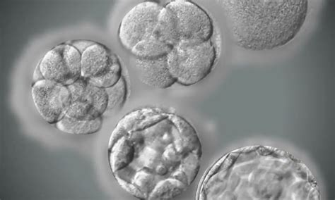 Perinatal And Postnatal Outcomes After Transfer Of Low Level Mosaic Embryos Comparable To
