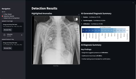 Ai In Chest X Rays Using Densenet 121 For Enhanced Diagnosis Tech4biz