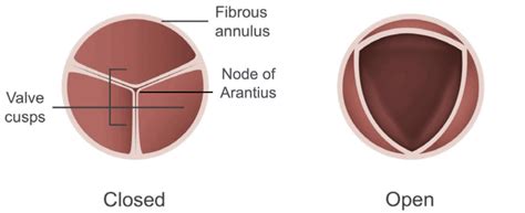 Echo Basics Aortic Valve • Litfl • Radiology Library