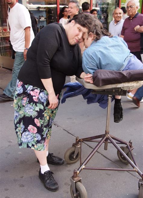 Lori And George Schappell Discuss Intimacy As Conjoined Twins