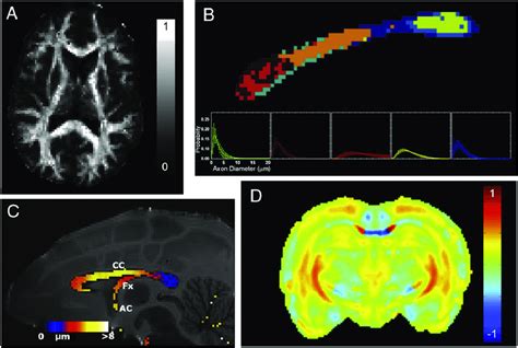 Micro Structural Features Extracted From Diffusion Mri A Axonal