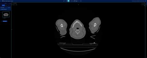 [feature request] display patient name · issue 3769 · ohif viewers