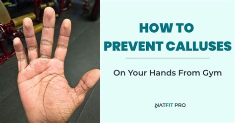 How To Prevent Calluses On Hands From Lifting A Complete Guide