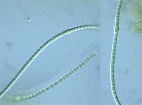 Anabaena Cylindrica