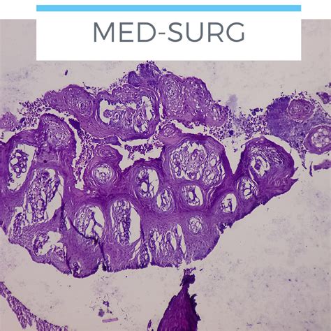 Nursing Care Of Osteomyelitis Straight A Nursing