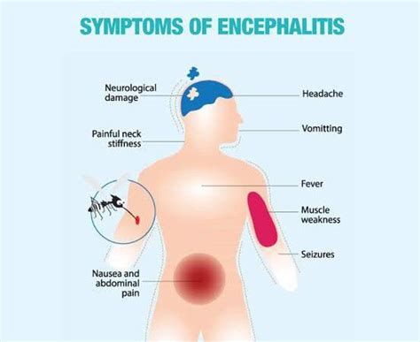 Symptoms Of Encephalitis Medizzy