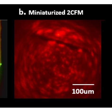 A Miniaturized 2 Color Fluorescence Microscopy M 2cfm Of Stained Download Scientific