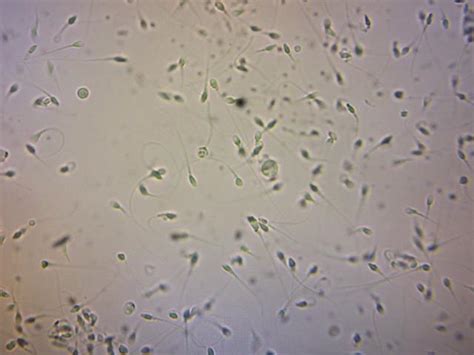 Sperm Masking Instance Segmentation Dataset And Pre Trained Model By Projects