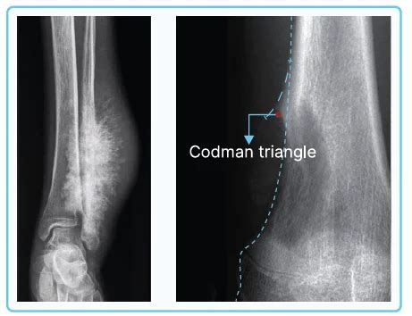 Orthopedics Neet Pg Image Based Prep High Yield Visuals
