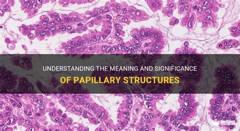 Understanding The Meaning And Significance Of Papillary Structures MedShun