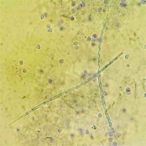 Dirofilaria Immitis Microfilariae Modified Knotts Test Magnification Download Scientific