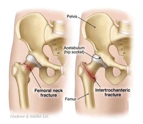 Patient Education Article Trinity Integrated Medicine
