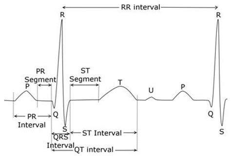 Intervalle Qt Genetic Analyses Of The Electrocardiographic Qt Interval