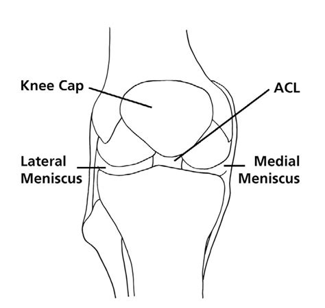 Anterior Cruciate Ligament Reconstruction Surgery Leeds Teaching