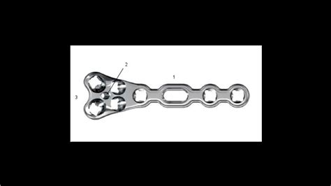 Variable Angle Locking Hand System For Fracture Repair And Deformity Correction Jandj Medtech