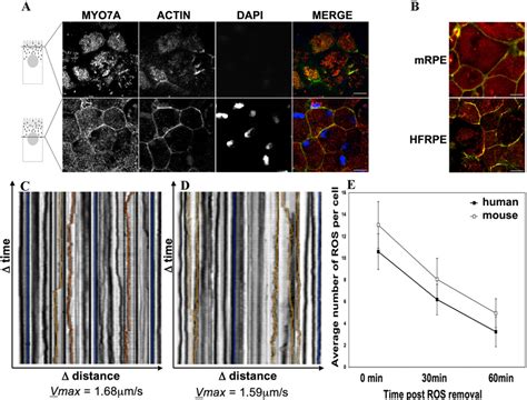 Myo7a In Cultured Human Fetal Rpe Cells And Comparison With Primary Download Scientific Diagram