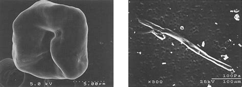 Polyethylene Globular Particles Imaged Using A Scanning Electron