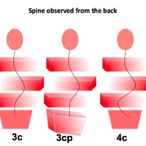 Schroth Curve Classification 992 Download Scientific Diagram