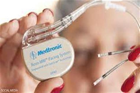 ما هو جهاز تنظيم ضربات القلب؟ وما هي دواعي استعماله؟ الكونسلتو