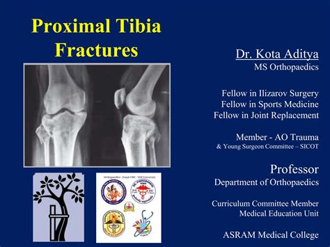 Proximal Tibia Fractures And Its Management Pptx
