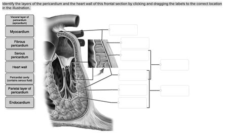 Solved Identify The Layers Of The Pericardium And The Heart Wall In