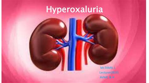 Hyperoxaluriapptx