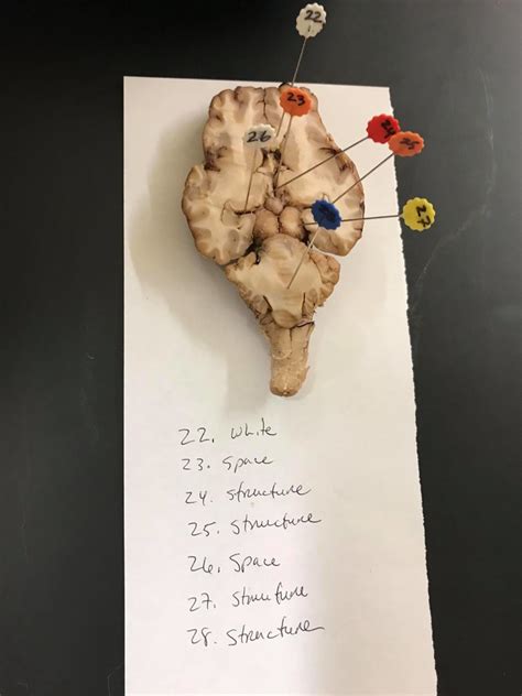 Physio Practical Exam Pic 2 Diagram Quizlet