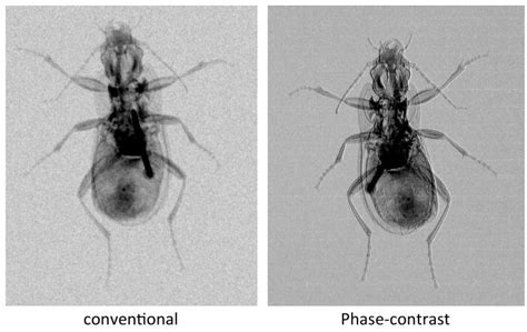 Detecting The Undetectable Transforming The Use Of X Rays 124 Years