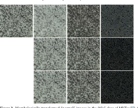 figure 2 from deep morphological anomaly detection based on angular