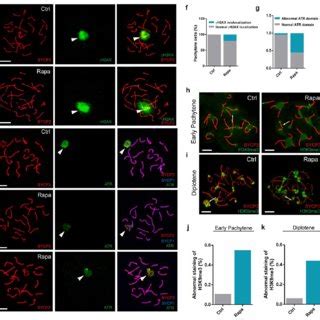 Abnormal Localization Of Sex Body Silencing Factors In Pachytene Download Scientific Diagram