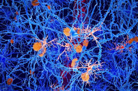 Csf Proteomics Services Quantitative Measure Of Neuro Markers