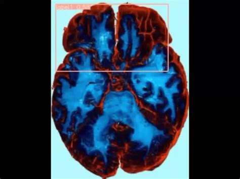 Vignesh Kasani On Linkedin Aimers Yolov8 Objectdetection Deeplearning Intern