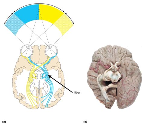 Visual Processing Flashcards Quizlet
