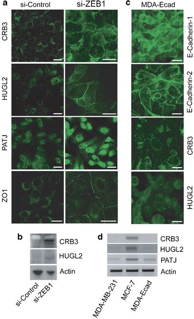 Cell Polarity Proteins Are Upregulated And Partially Redistributed To